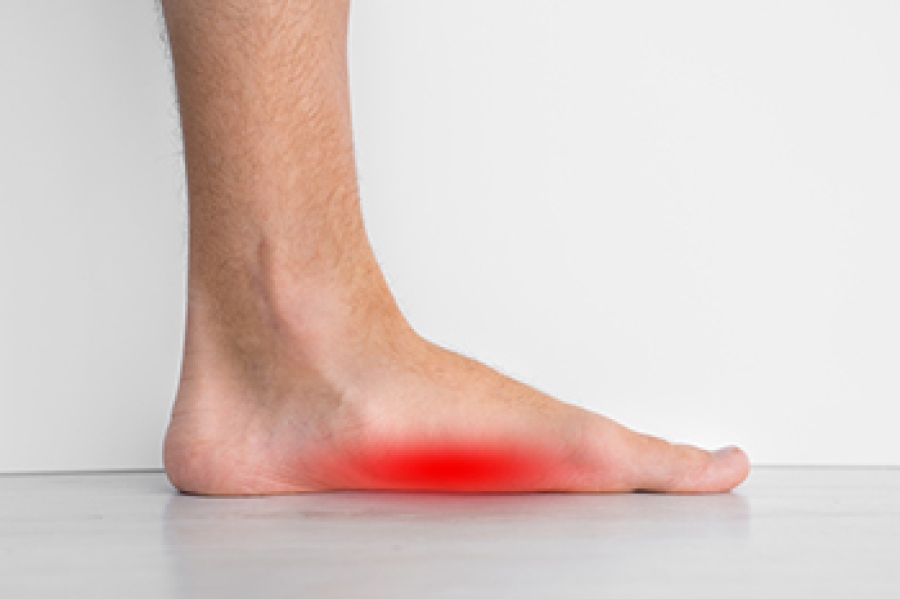 Causes of Flat Feet